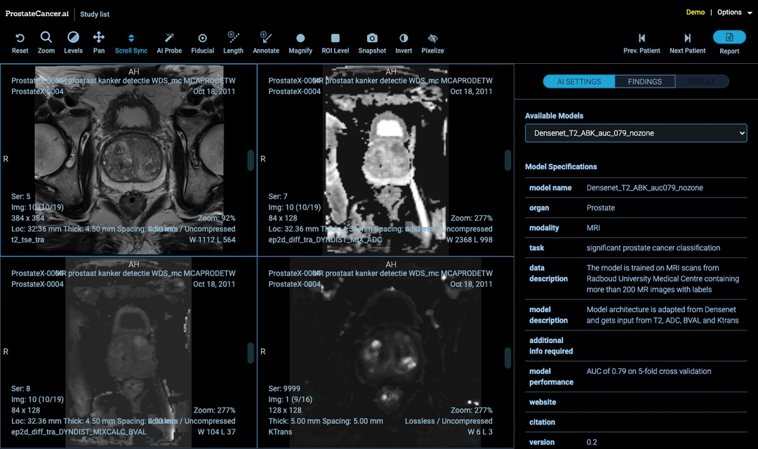 Product showcase | OHIF
