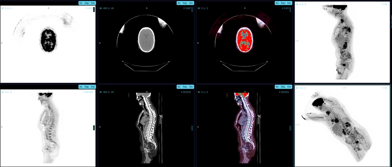 Product showcase | OHIF