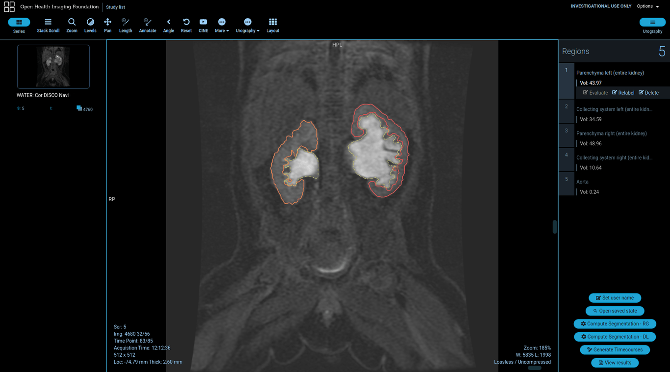 Product showcase | OHIF